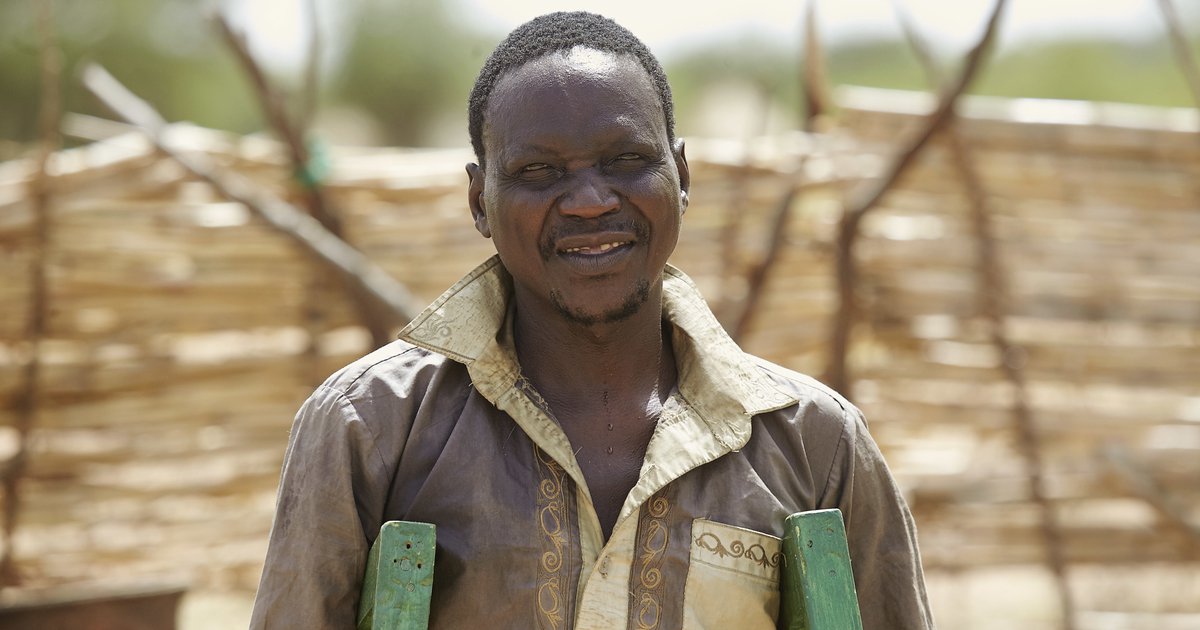 Why do people hide their leprosy symptoms and what does this mean for them?